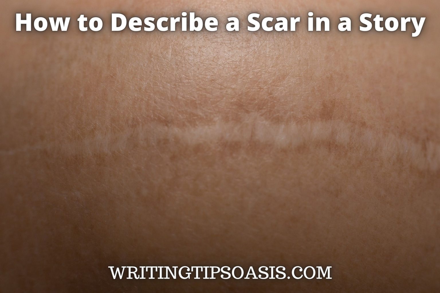 How to Describe a Scar in a Story - Writing Tips Oasis - A website ...